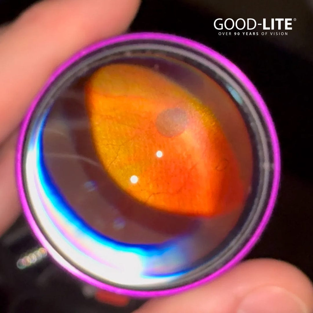 Eye Model: Pocket Retina for Retinal Examinations | Good-Lite – Good ...